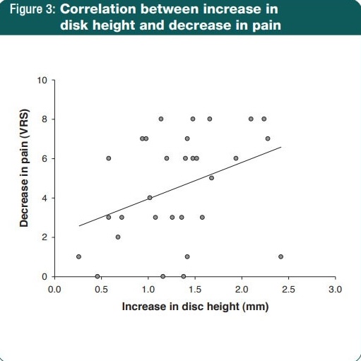 DRX9000 - Non-Surgical Spinal Decompression